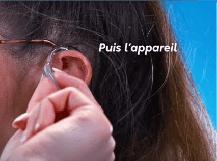 Comment mettre un appareil auditif BTE ? - Laboratoires Unisson