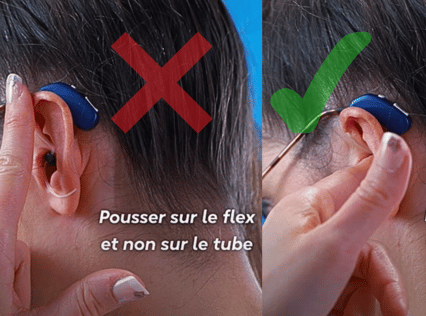 Comment mettre un appareil auditif BTE thin tube ? - Laboratoires Unisson